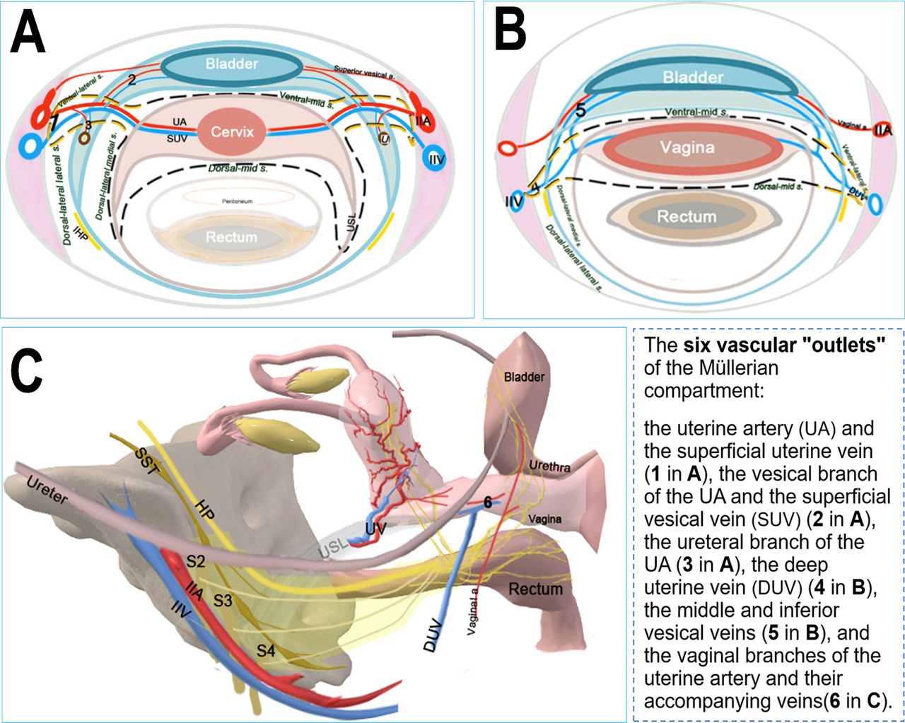 LACC trial: not the end of minimally invasive radical hysterectomy, but ...