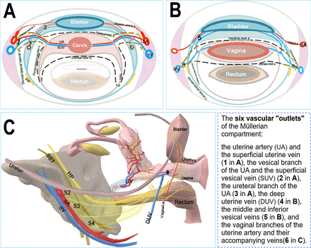 LACC trial: not the end of minimally invasive radical hysterectomy, but ...